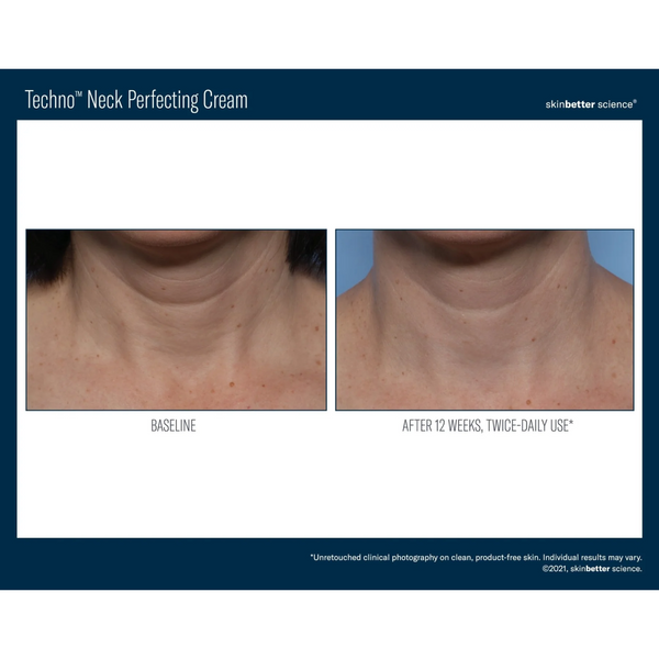 SkinBetter Techno Neck Perfecting Cream – Anti-Aging Vancouver
